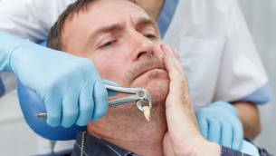 Die häufigsten Fragen und Antworten zur Zahnentfernung