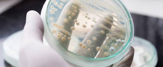 Scheidenpilz » Ursachen, Symptome, Diagnose & Behandlung
