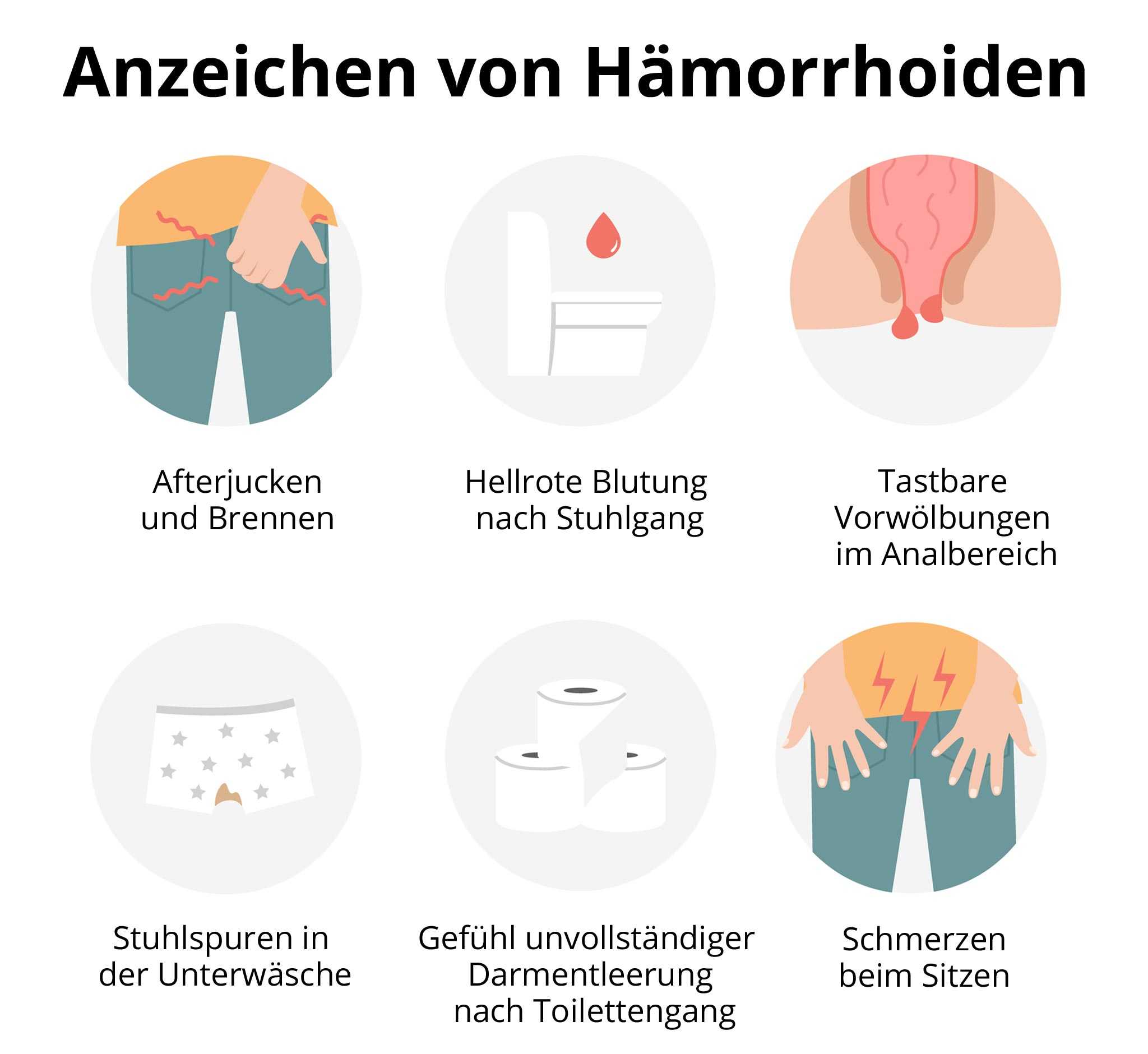 Was sind Anzeichen für Hämorrhoiden? Was sind Anzeichen für Hämorrhoiden?