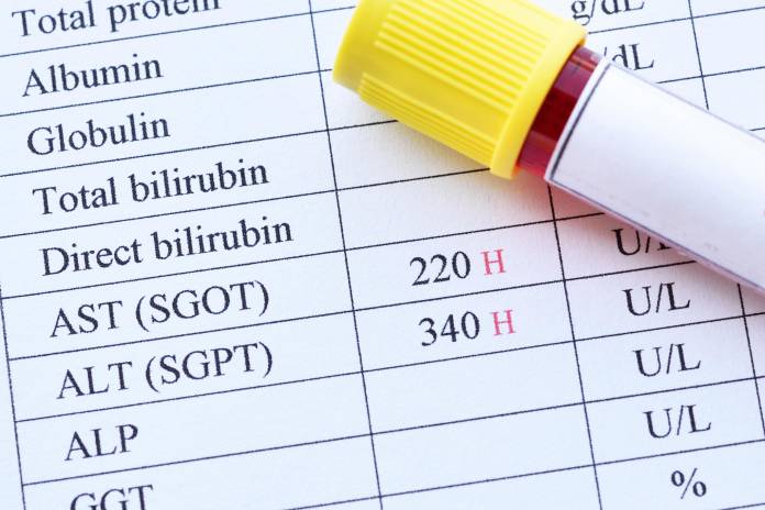 Blutwert ALT / GPT » Normalwerte, Erhöhung, Diagnose