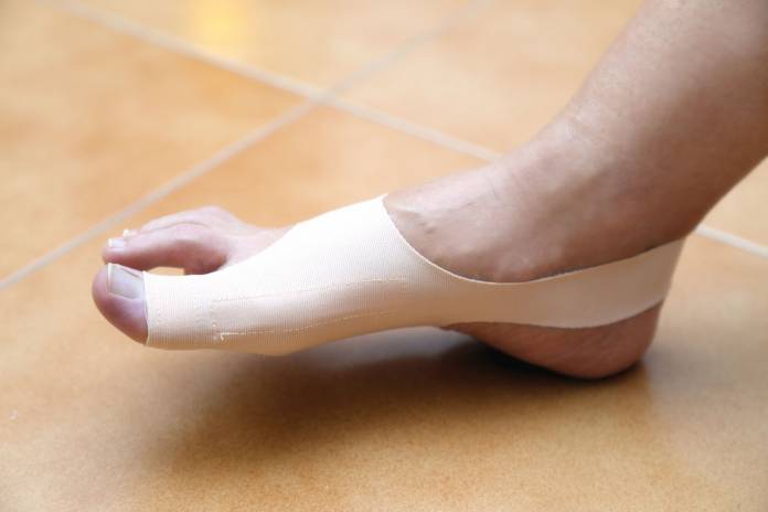 Was bewirkt eine Hallux-valgus-Bandage?