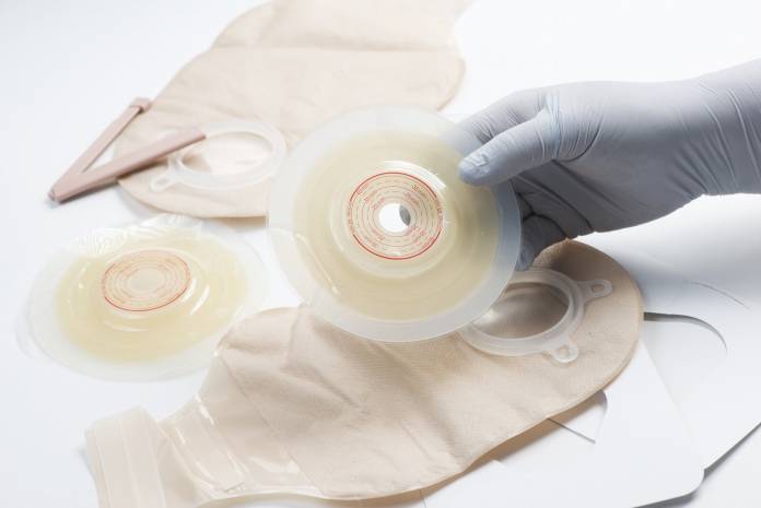 Kolostoma und Ileostoma: Wo liegen die Unterschiede?