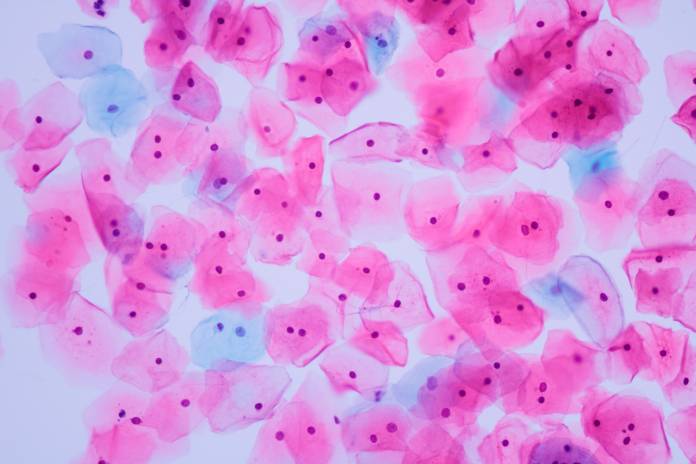 Konisation - Gewebeprobe vom Gebärmutterhals