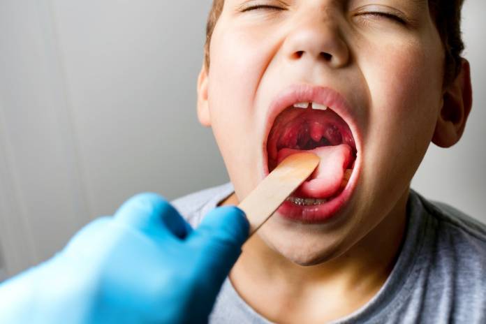 Mandelentzündung: Woran erkennt man sie? - Interview mit Prof. Windfuhr